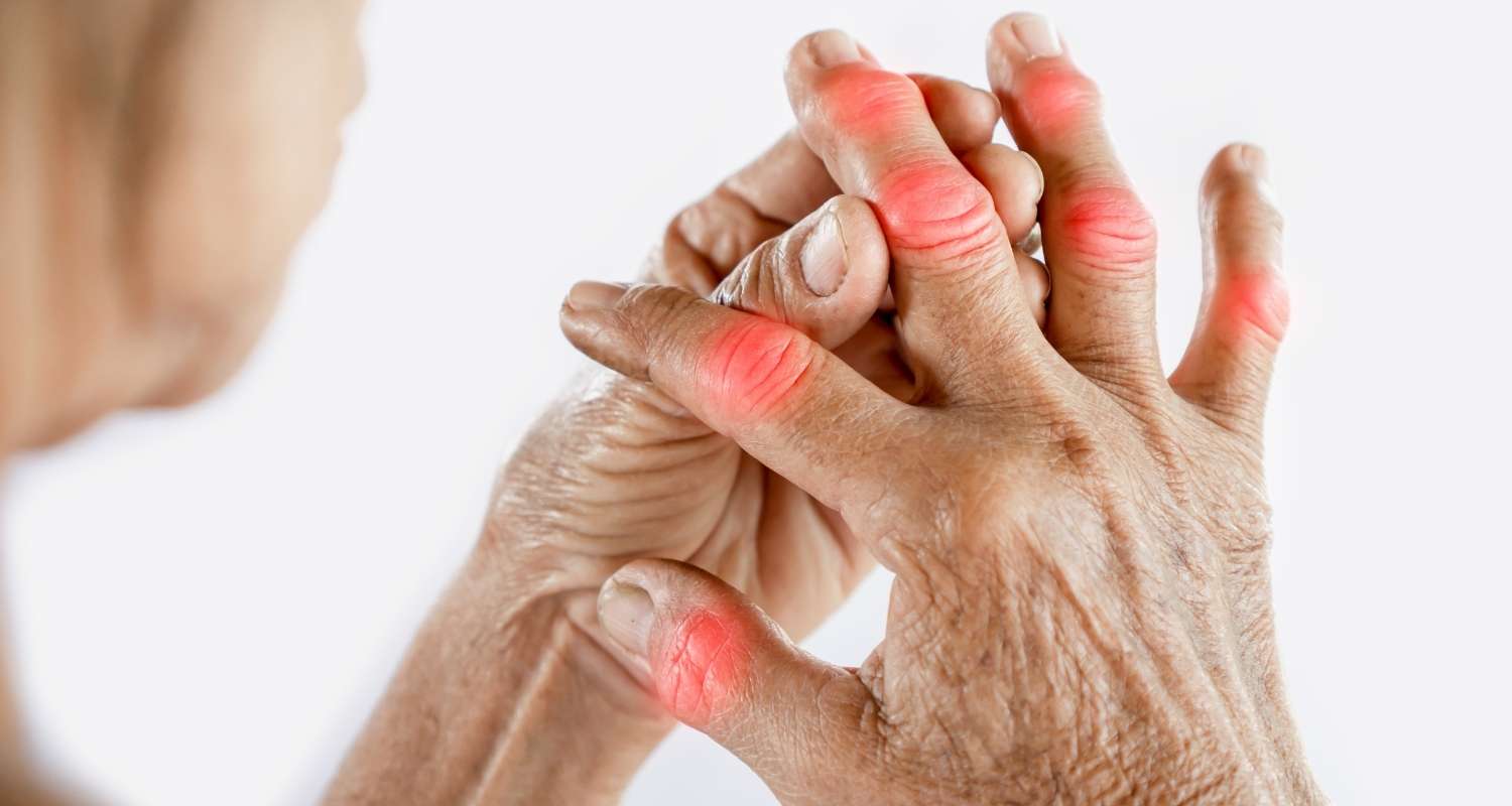 Best Treatment Options for Finger Stiffness – Joint Jack